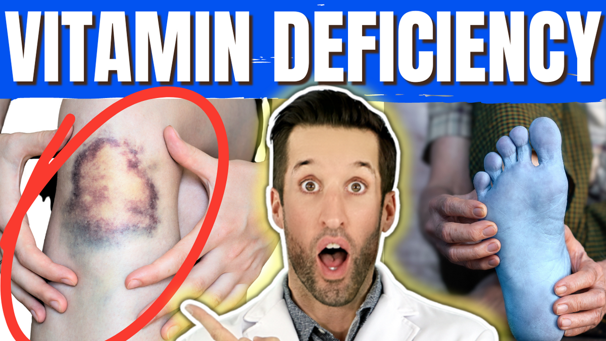 10 Body Warning Signs & Vitamin Deficiencies You Shouldn't Ignore ...